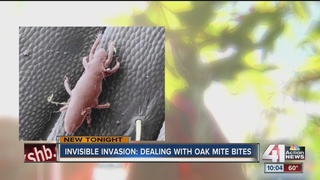 Many Kansas Citians suffering from Oak Mite bites - KSHB.com 41 Action News